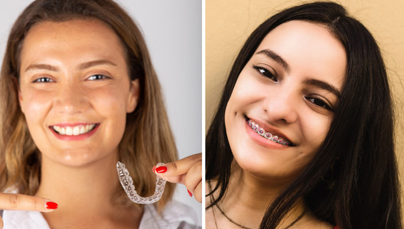 Invisalign® vs. Traditional Braces: Which Is Right for You?
