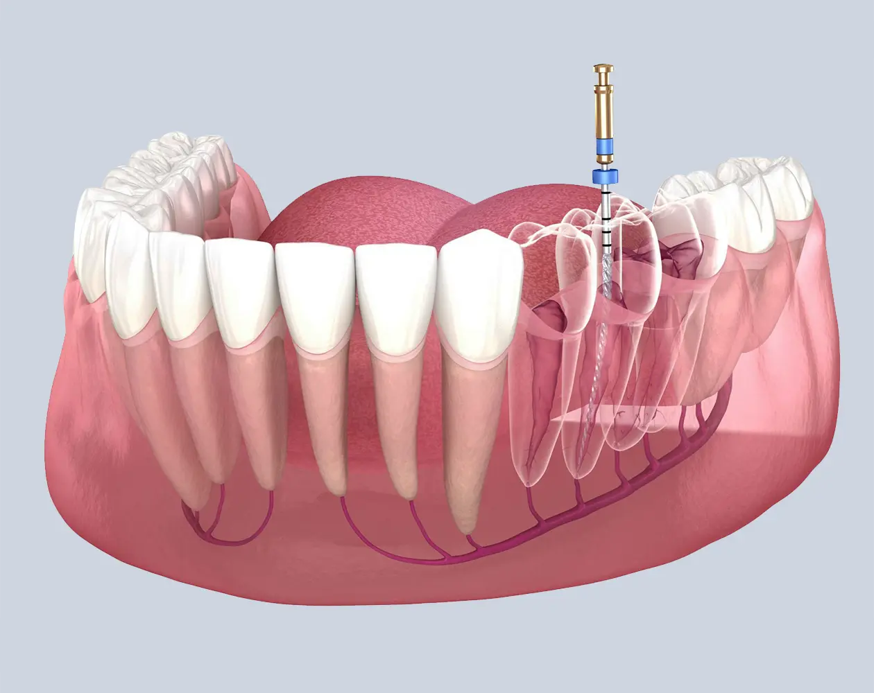Endodontic Surgery Ann Arbor MI | Stadium Family Dentistry